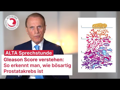 Gleason Score verstehen: So erkennt man, wie bösartig Prostatakrebs ist