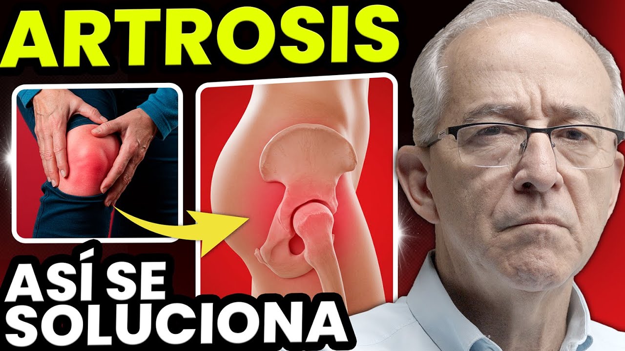 🦴 ARTROSIS Tratamientos Naturales y Consejos para Aliviar el Dolor - Oswaldo Restrepo RSC