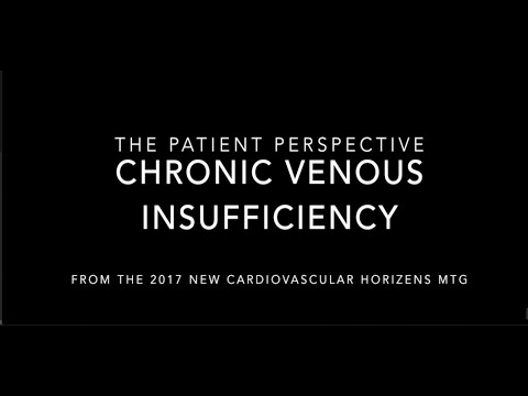 Living with Chronic Venous Insufficiency: A Patient's Perspective