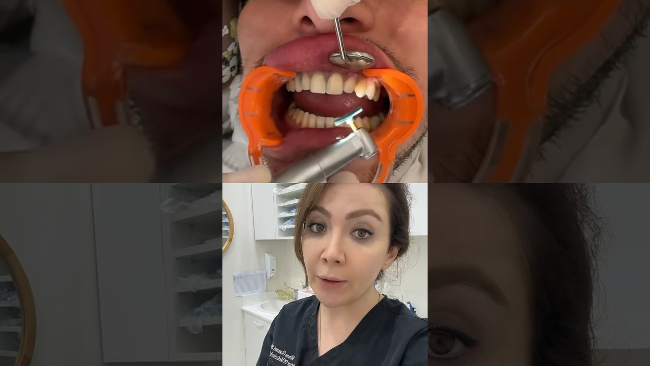 How Can We Close The Gap Between Front Teeth Without Adding Any Material?!!