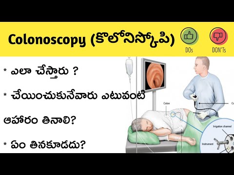 Colonoscopy in Telugu|| Procedure|| Preparation .