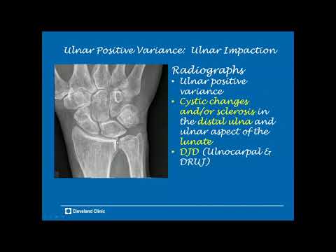 MRI wrist