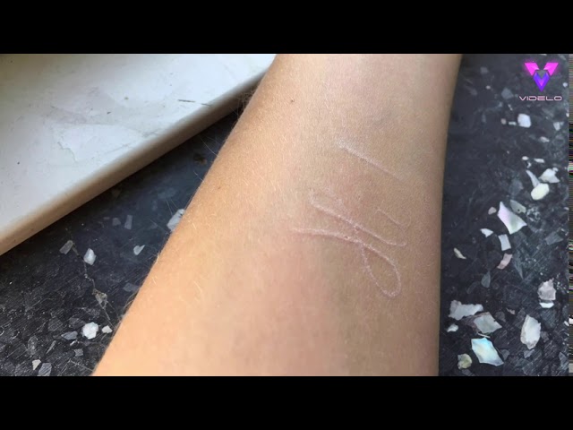 La rara enfermedad de esta joven convierte su piel en un lienzo humano ...