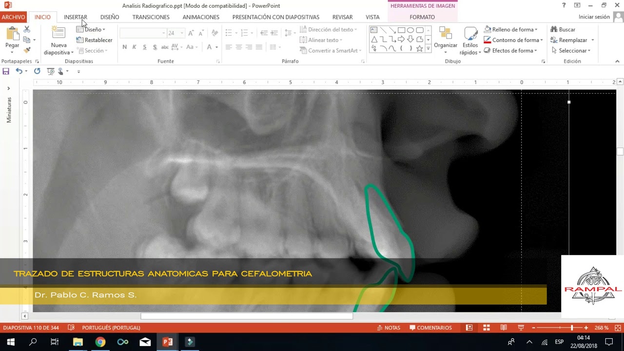Trazado para Cefalometria en Power Point