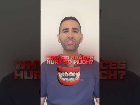 Does braces hurt? 😩 #orthodontist #dentist #braces