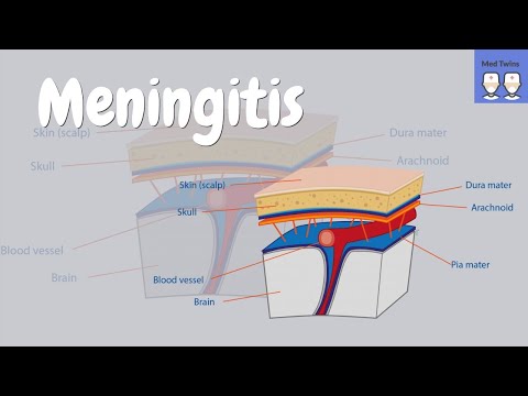 Meningitis [bacterial vs viral, symptoms, Kernig's sign, clinical clues, meningococcal infection]