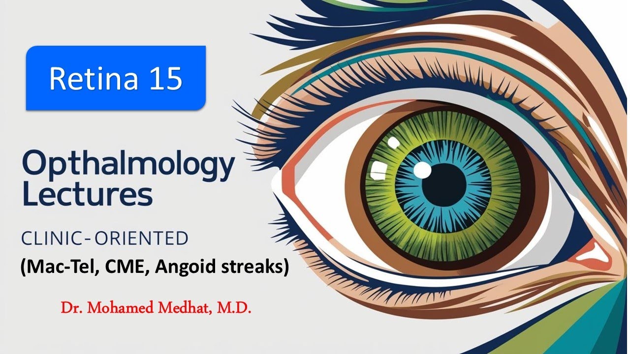 Mac- Tel & CME & Angoid streaks : Retina 15