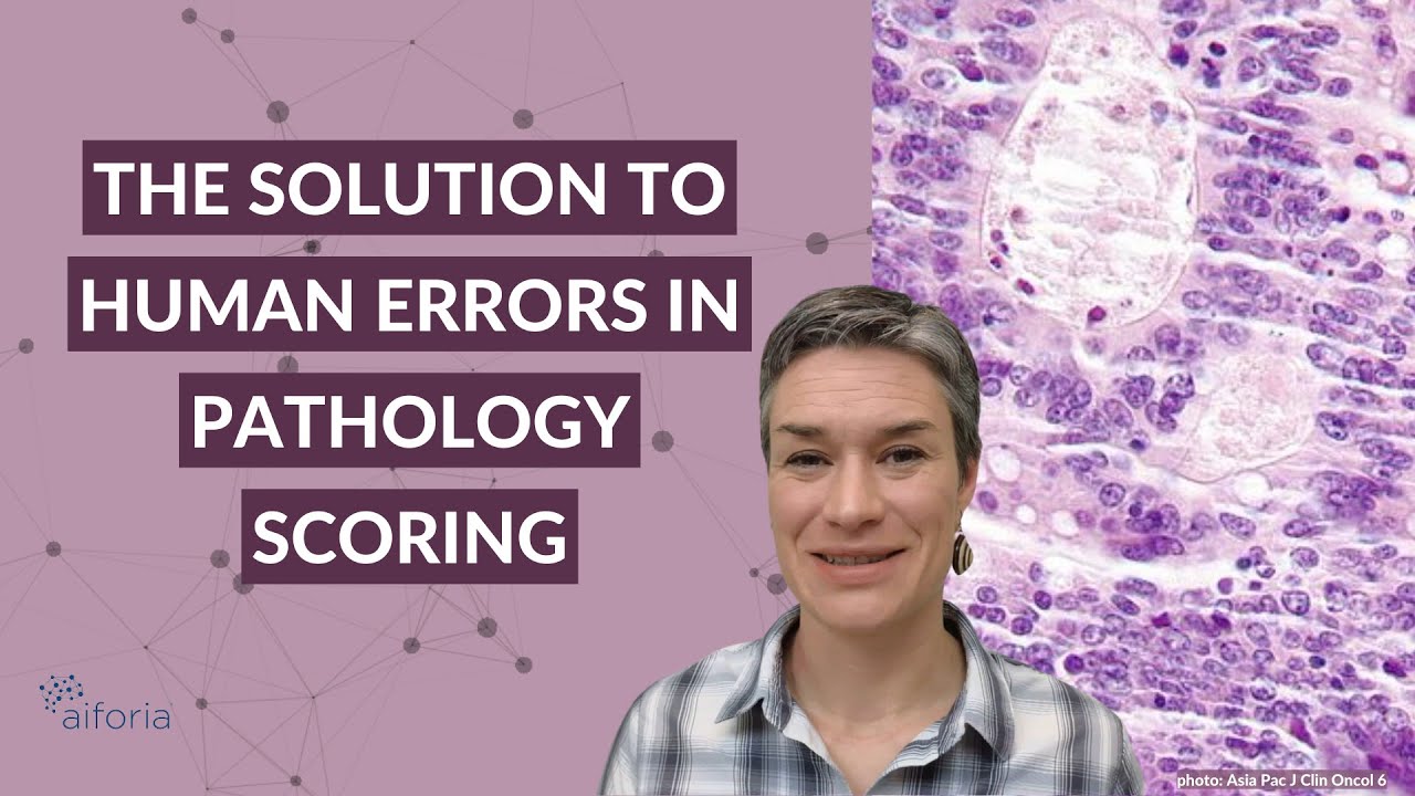 Detecting Tumor Infiltrating Lymphocytes with Tissue Image Analysis