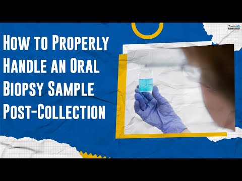 How to Properly Handle an Oral Biopsy Sample Post-Collection