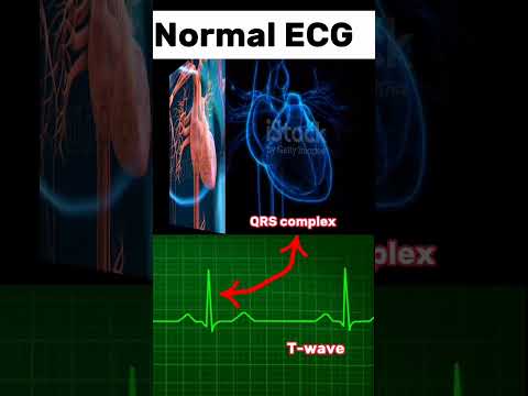 #ECG#Normal ECG
