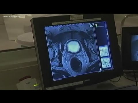 Prostate Cancer is the most common cancer among men