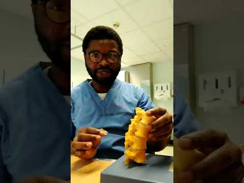 Measuring CSF Opening Pressure