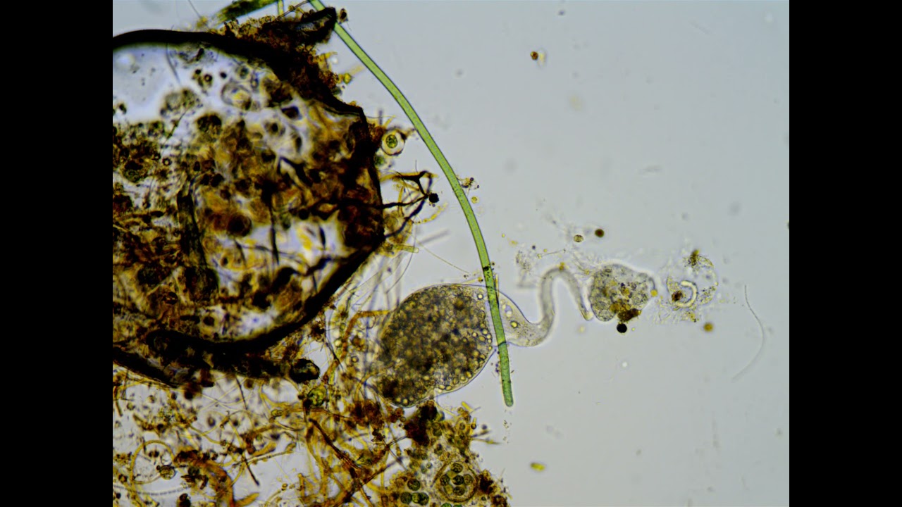 Dileptid kills and eats Strobilidium caudatum - It Came from the Pond