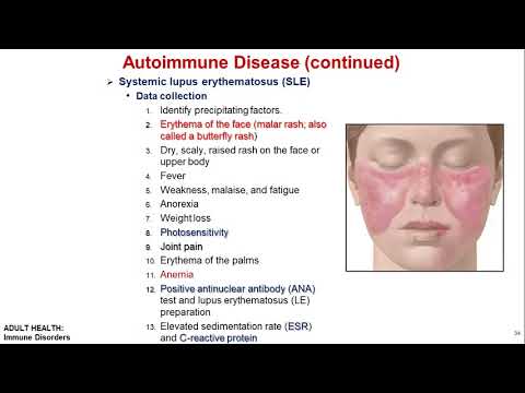 Autoimmune Disease Systemic Lupus Erythematosus (SLE) - Med-Surg NCLEX REVIEW 2021 - Immune System