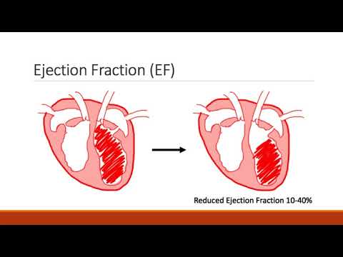 Entresto Patient Education Video