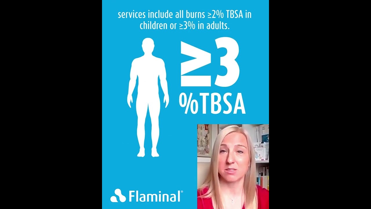 Burns Eps 7:  When to refer a burn?