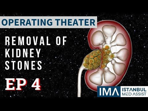 What is Flexible Ureteroscopy? - Operating Theater Ep.04