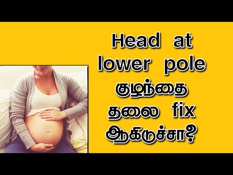head at lower pole meaning in tamil/head at lower pole during pregnancy in tamil/reshu pregnancy tip