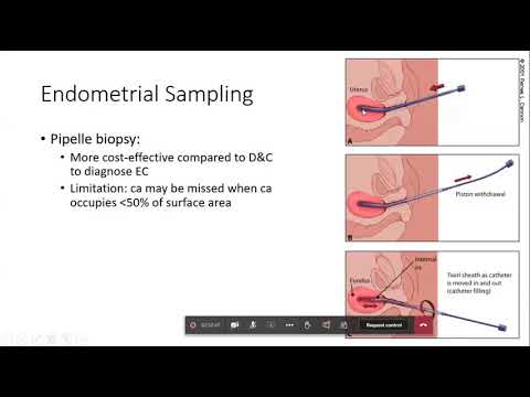 MANAGEMENT OF POSTMENOPAUSAL BLEEDING