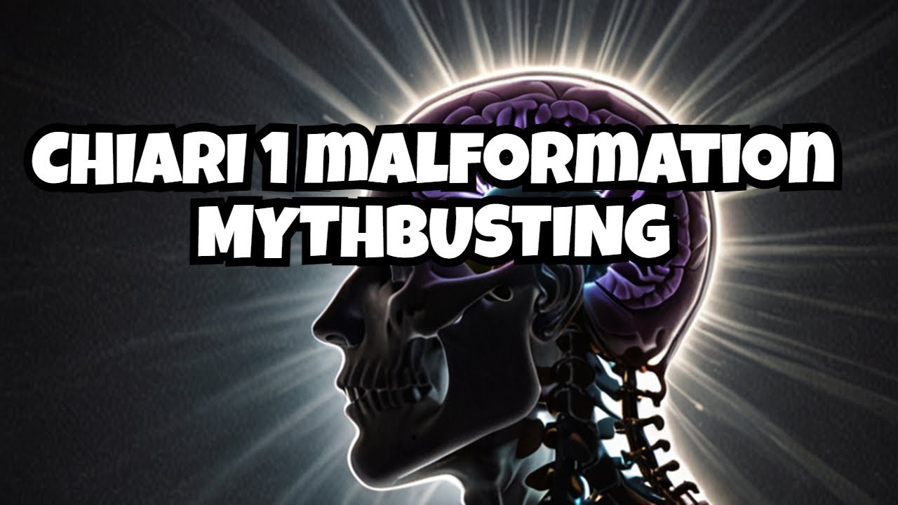 Expert Insights: Chiari 1 Malformation Explained