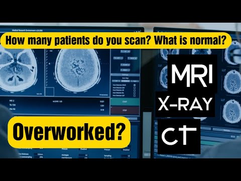 How many patients a day is too many for a Rad Tech? MRI | X-RAY | CT
