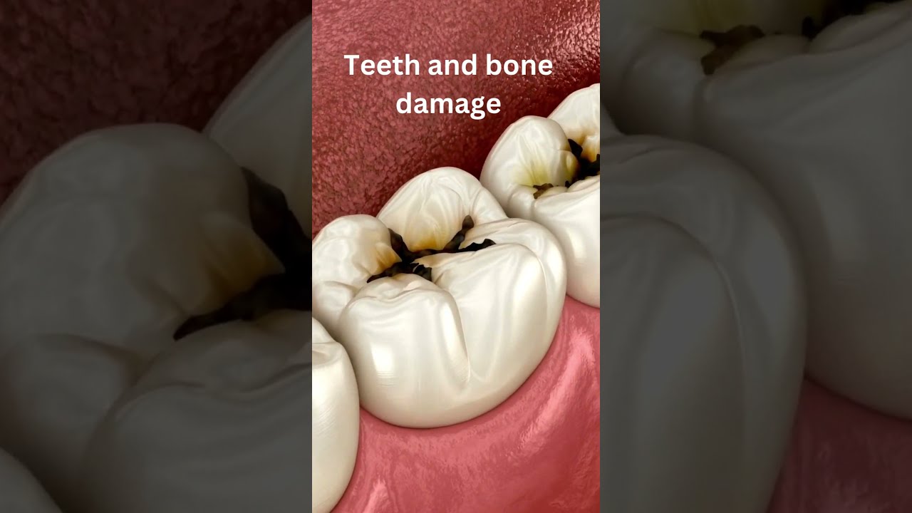 The Truth About Coca-Cola: What It Does to Your Health | Part 1