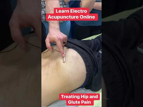 Learn electroacupuncture online now #electroacupuncture #acupuncture 