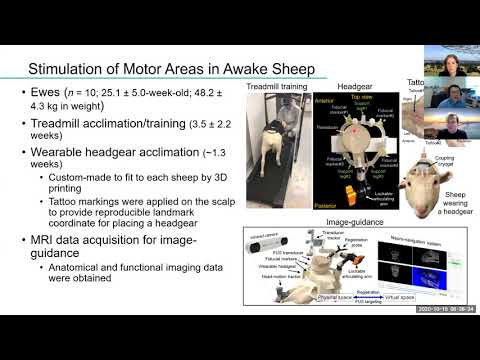 US neuromodulation of motor function and epilepsy with Dr. Seung-Schik Yoo