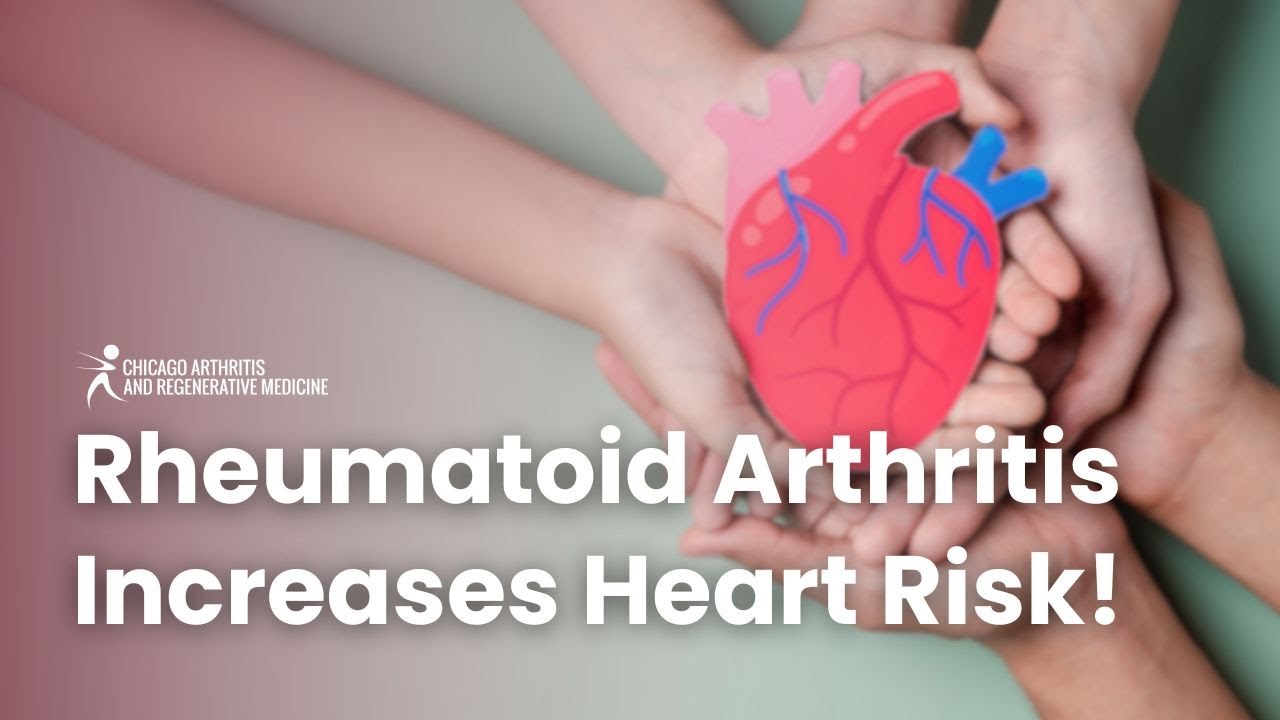 How Rheumatoid Arthritis Increases Heart Risk—and Ways to Safeguard ...