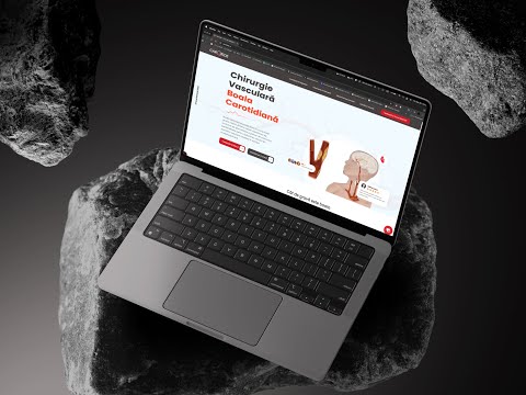 Creare Site de Prezentare Timisoara - Studiu De Caz Carotide.ro - Agentie Web Design ProjectMedia