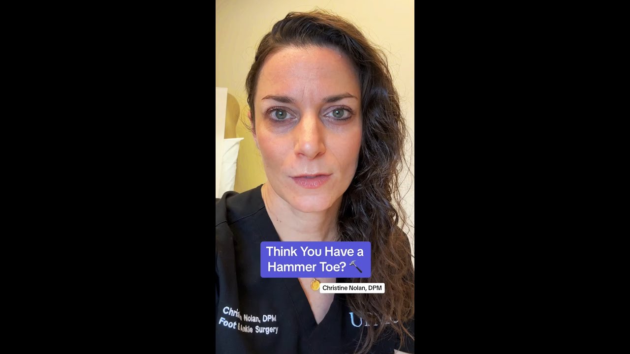 Think You Have a Hammer Toe?