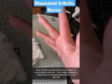 2nd Abatacept Infusion & Swollen Joints #shorts #rheumatoidarthritis #ra