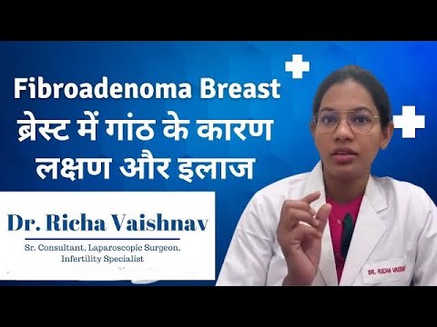 Fibroadenoma Breast :- ब्रेस्ट में गांठ के कारण लक्षण और इलाज ।