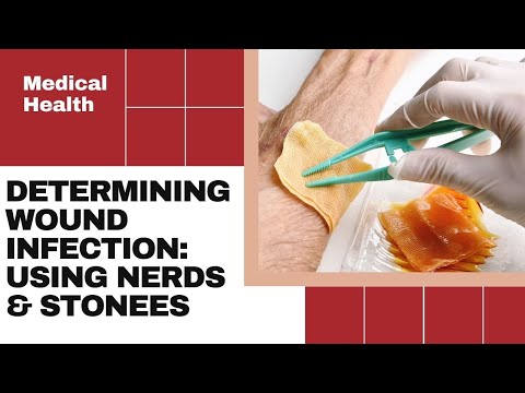 Nerds & Stonees: Determining Infection