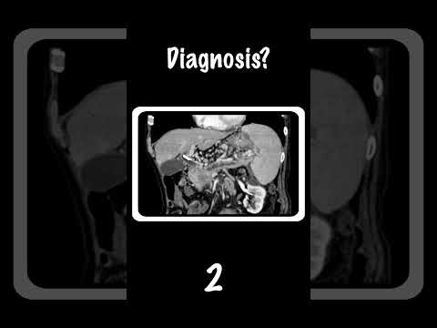 Guess the Diagnosis #15