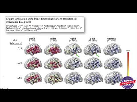 EADDL 2021 - Jon Kleen, MD PhD - Ictal Cinema: New Technology that shows how seizures actually move