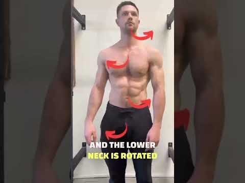 Why Your Spine Is Predicatably Twisted & Asymmetrical #posture #scoliosistreatment #backpain #pain