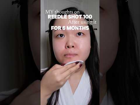 REEDLE shot 100 after 6 MONTHS #reedleshot #vtcosmetics #kbeauty #largepores #koreanskincare