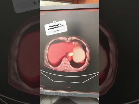 #nuclear #ytshorts #yt #trending #cancer #anatomy #medical #health #radiology #music