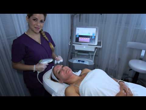 Ematrix Sublative Rejuvenation Treatment