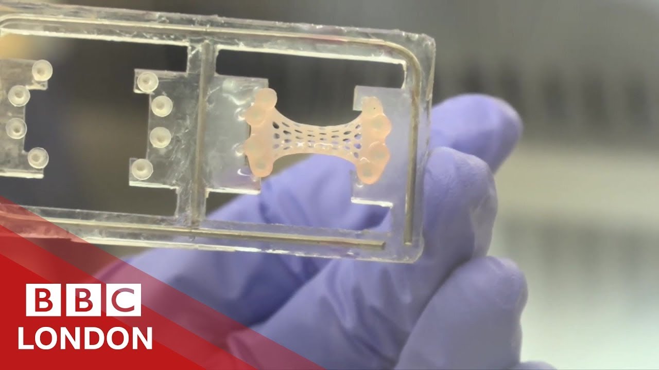 Beating heart patches could change the lives of heart failure sufferers- BBC London