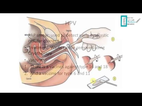 STDs Overview