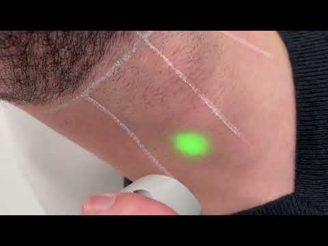 Lux Laser Labs - From $58.50 - New York | Groupon