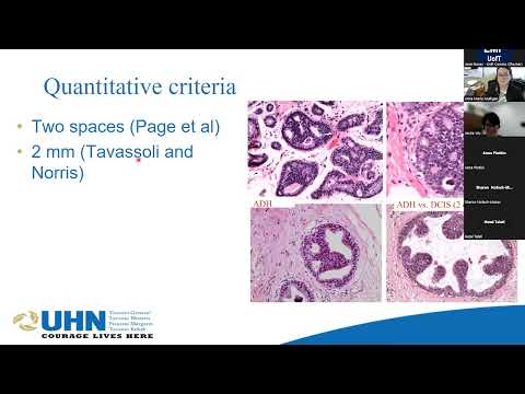 Breast Pathology community of interest meeting 8 May 2023