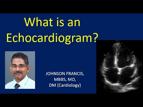 What is an Echocardiogram?