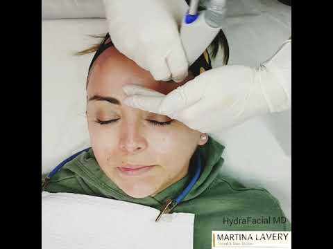 HydraFacial MD @ Martina Lavery Dental & Skin Studio