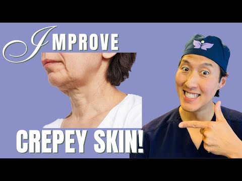 How To Improve Crepey Skin Holistically!