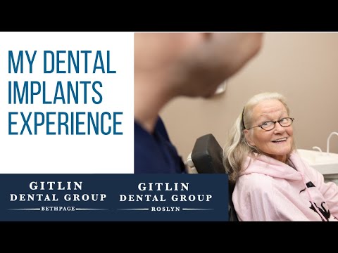 Why I Feel Good About My Teeth With All-on-X Dental Implants