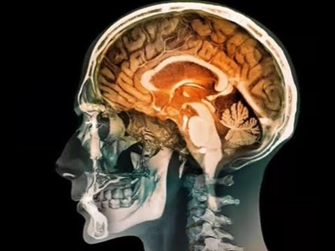 Multiple Sclerosis Symptoms and Management Tips