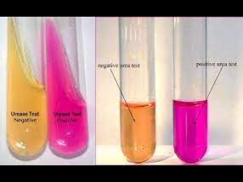 Urea hydrolysis test or Urease test
